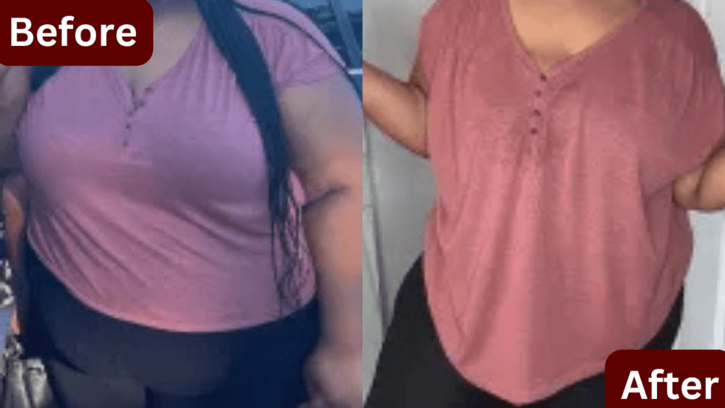 Slimming Wires In Port Elizabeth | Weight Management 🩺