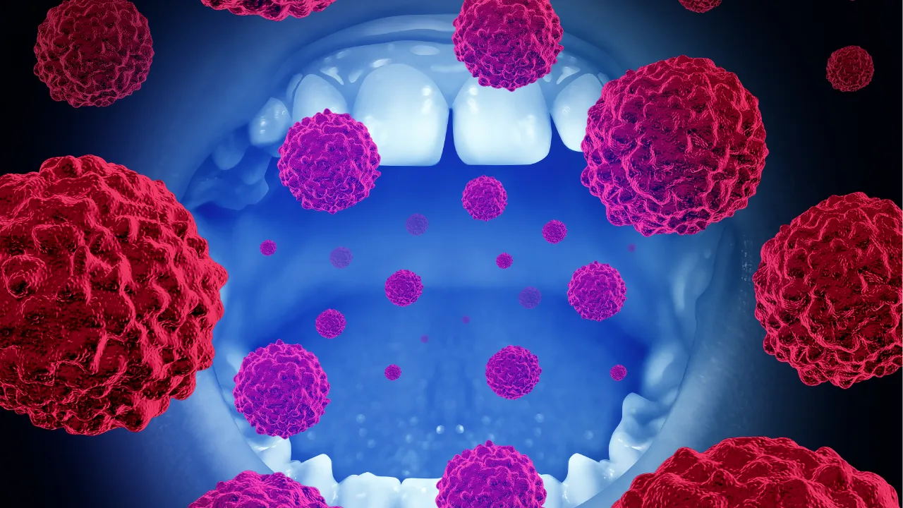 How to Recognize and Treat Common Oral Infections